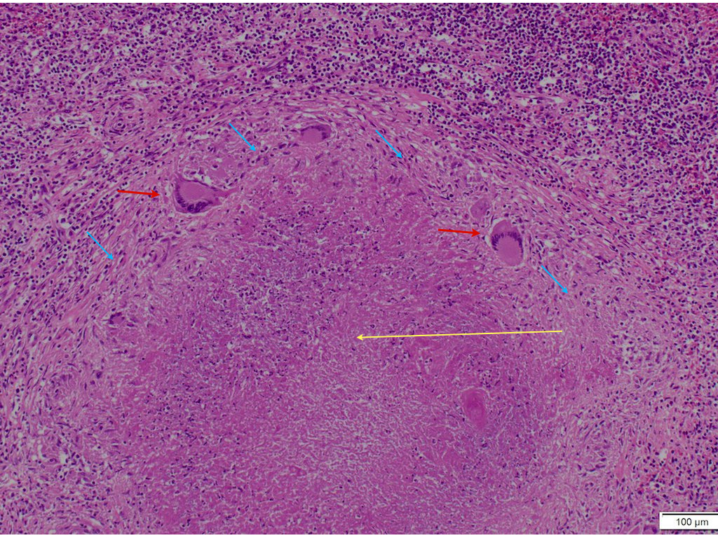 Questions 199-205: General pathology image questions | Pathology Review ...